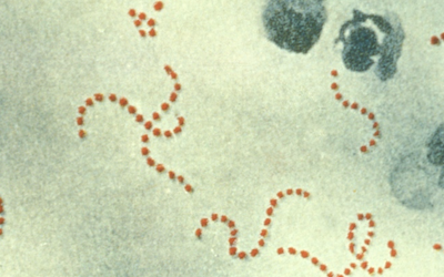 Streptococcus group A - Costa Tropical Gazette News